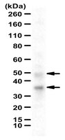 Anti-FcRn/FCGRT Antibody | ABF189